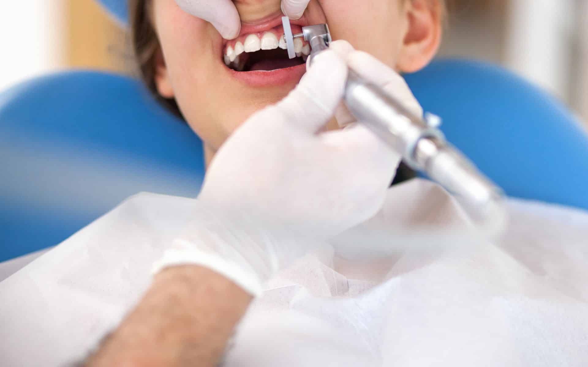 NHS Dental Charges Set to Rise as Cost of Care Increases in April 2025